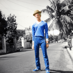 Yellowman’s Inspiring Rise: From Abandoned Albino in Jamaica to ...