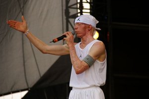 Yellowman’s Inspiring Rise: From Abandoned Albino in Jamaica to ...