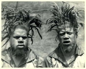The Muse Brothers: Two black albinos kidnapped and displayed as freaks ...