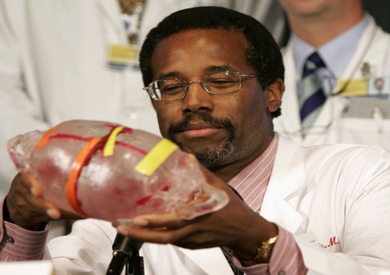 Ben Carson's Twin Separation Surgery | Face2Face Africa