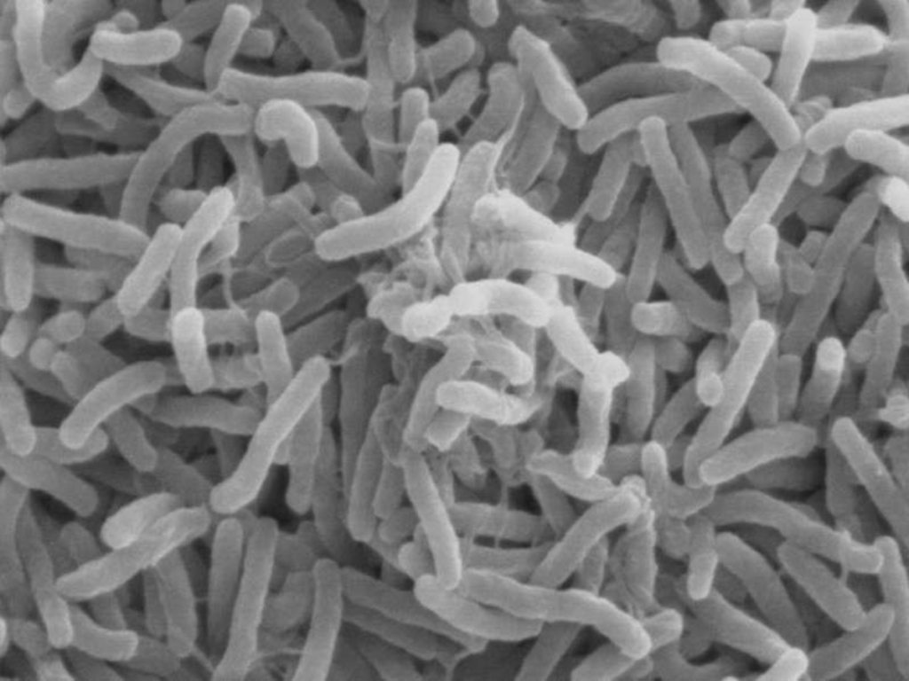 Africa faces worst cholera surge in 25 years as rainy season fuels ...