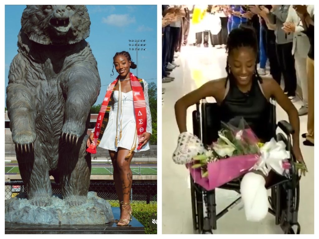 College grad who lost both legs in freak vacation accident sues ...