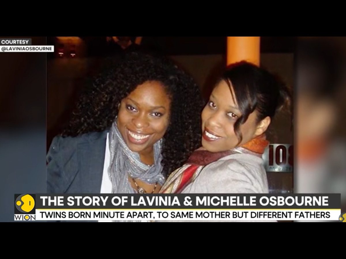 How these twin sisters were born with different dads, in UK's first ...